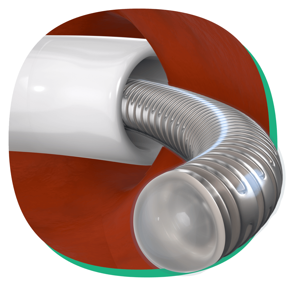 Aristotle 24 Guidewire | Scientia Vascular